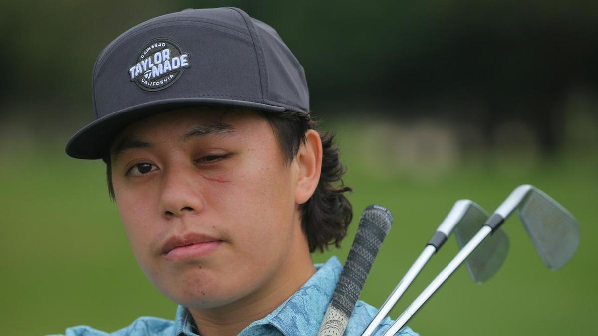 Blinded golf prodigy Jeffrey Guan opens up about freak on-course hit ...