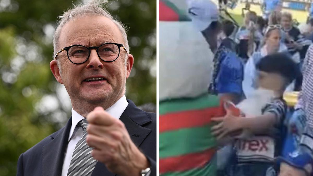 Anthony Albanese cites Reggie the Rabbit mascot’s weight as he defends ...