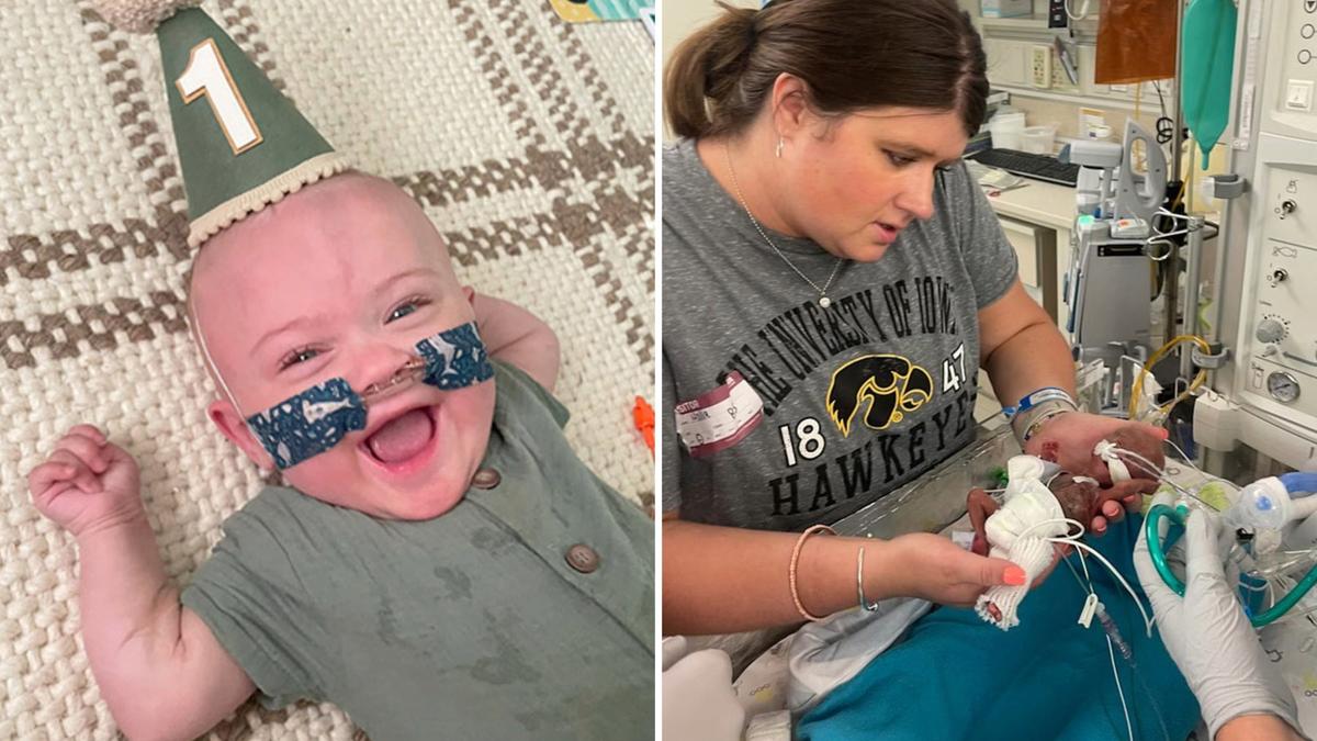 Nash Keen: World’s most premature baby celebrates first birthday a ...