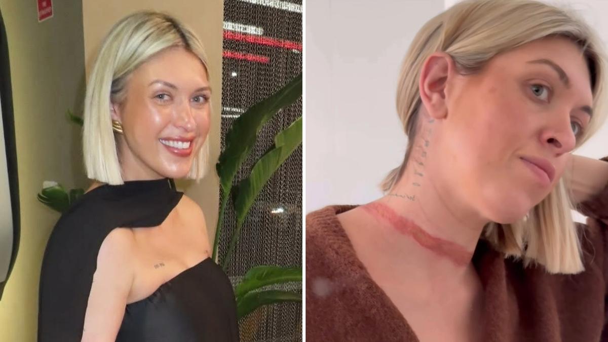 Eli Moulton: Influencer suffers frightening fashion mishap that left ...